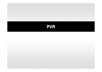 디지털미디어 pvr Personal Video Recorder